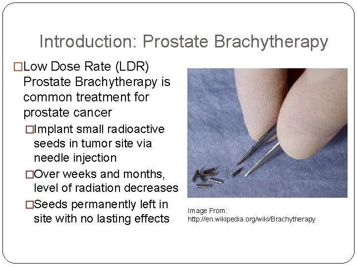 Photoacoustic Imaging of Prostate Brachytherapy Seeds in Ex