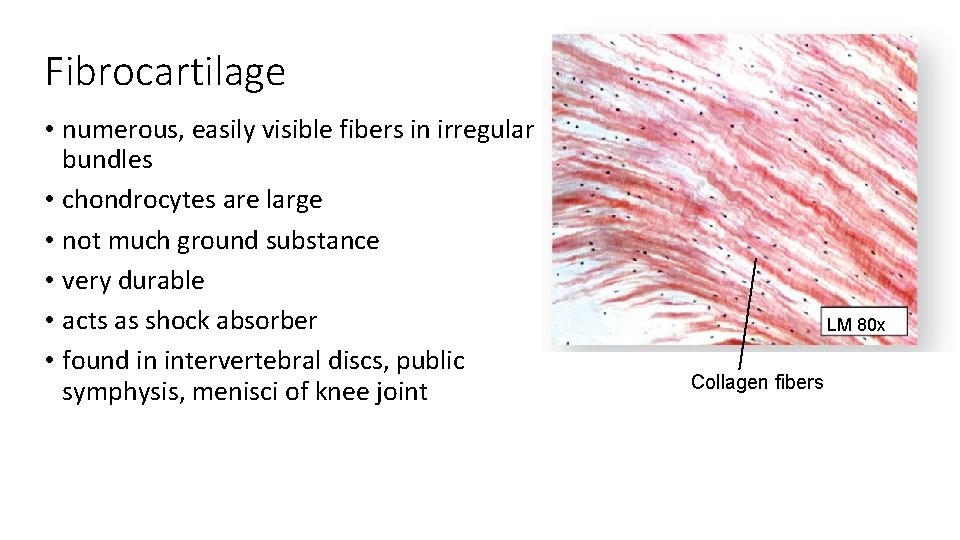 Chapter 6 7 Lab Cartilage and Bones Axial