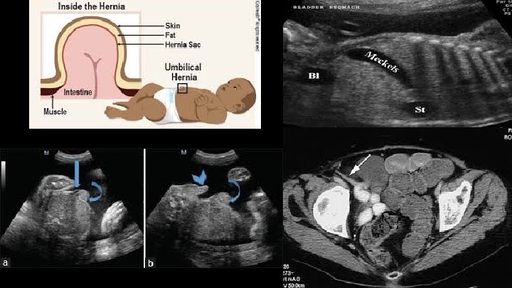 Fetal Abdominal Anomalies DMS 443 By Lauren Sanchez