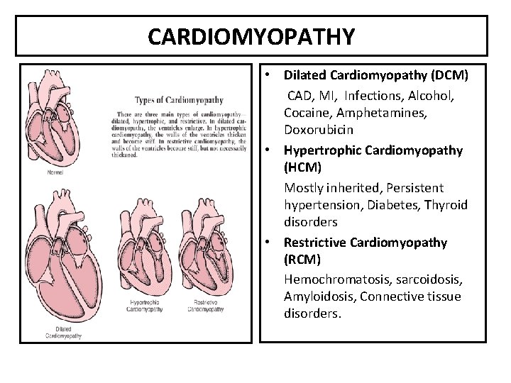 HEART FAILURE HYPERTENSION with TYPE 2 DIABETES MELLITUS