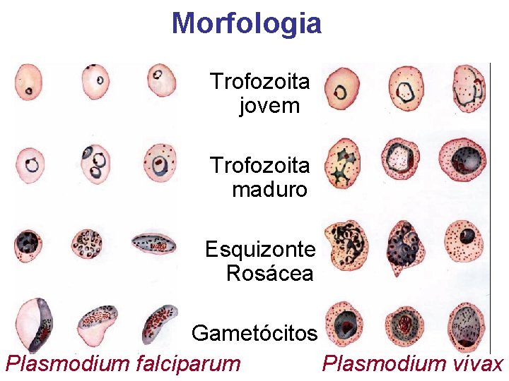 Plasmodium sp Malria Malria ou Paludismo Doena tropical