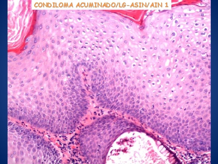 PROTOCOLOS DE SEGUIMIENTO Y TRATAMIENTO DE LAS LESIONES
