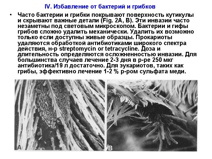 Scanning electron micrographs of crustaceans A first cheliped