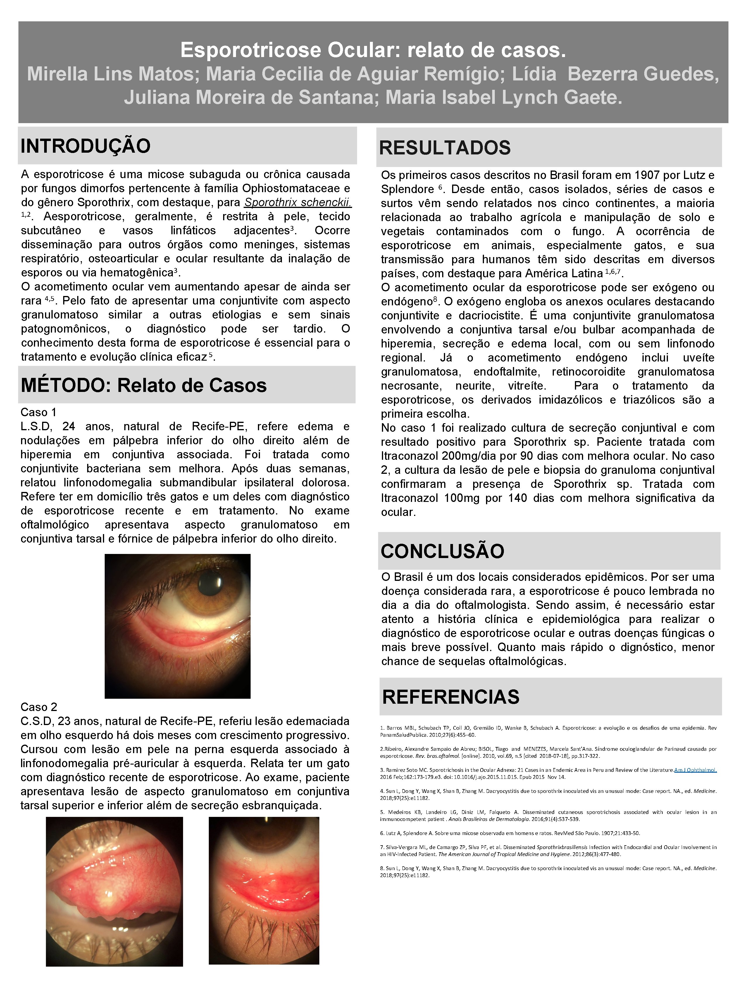 Esporotricose Ocular relato de casos Mirella Lins Matos