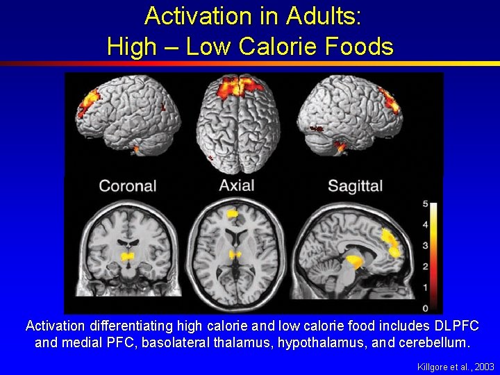Modulators of Orbitofrontal Activation in Response to Food