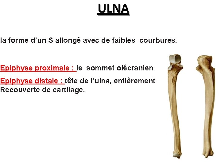 Fracture des 2 os de lavant bras Dr