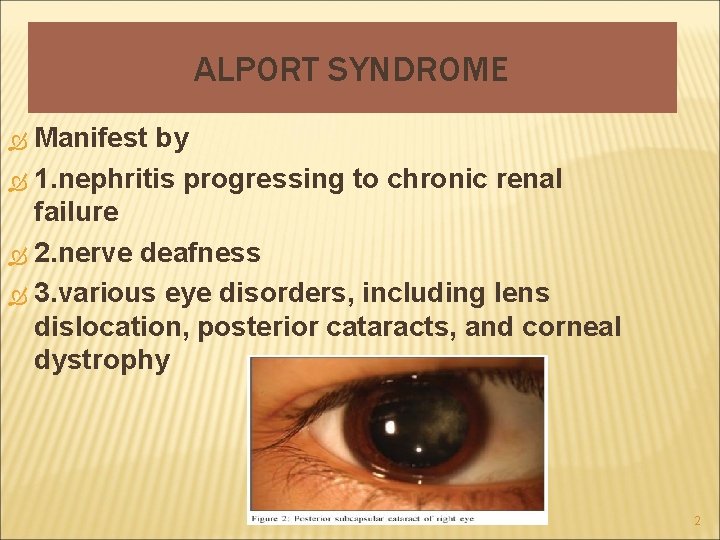 Hereditary nephritis 1 a group of hereditary glomerular