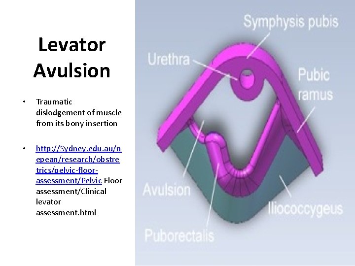 Vaginal assessment of pelvic floor Mummy MOT training