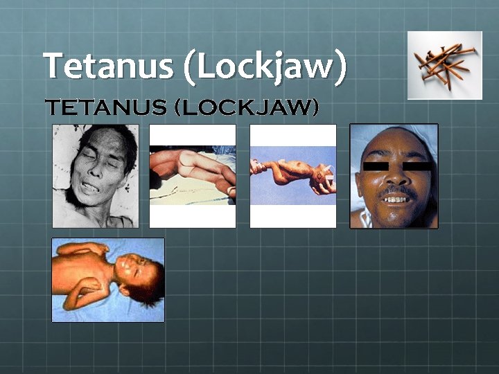 PNS Disorders Spinal Cord Injury Megan Mc Clintock