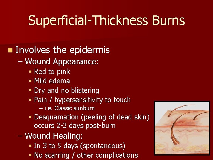 Management of the Burn Injured Client Anatomy of
