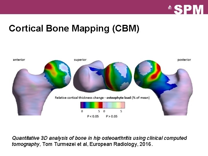 Statistical Parametric Mapping for f MRI VBM Guillaume