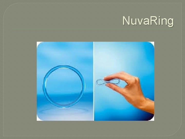 Breastfeeding and Contraception Jennifer Meyers Certified Nurse Midwife