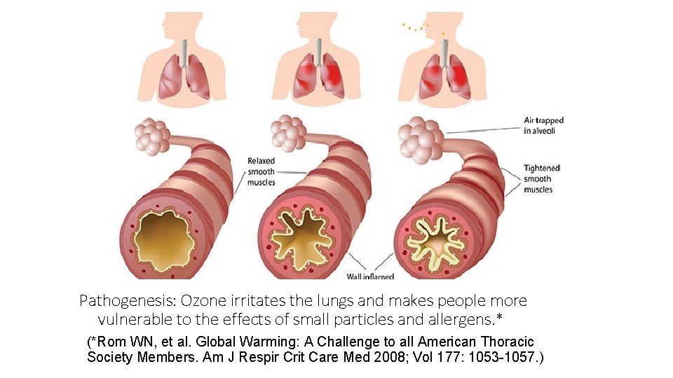 What Physicians Can Do about Air Pollution Climate
