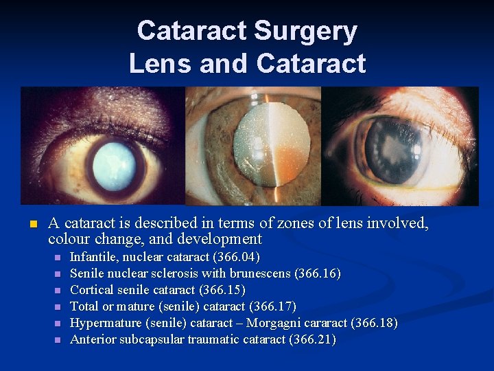 CATARACT SURGERY Christopher L B Canny MD FRCSC