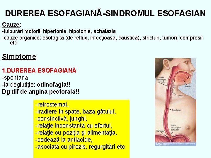 SINDROMUL DUREROS ABDOMINAL 1 Acut abdomen acut chirugical