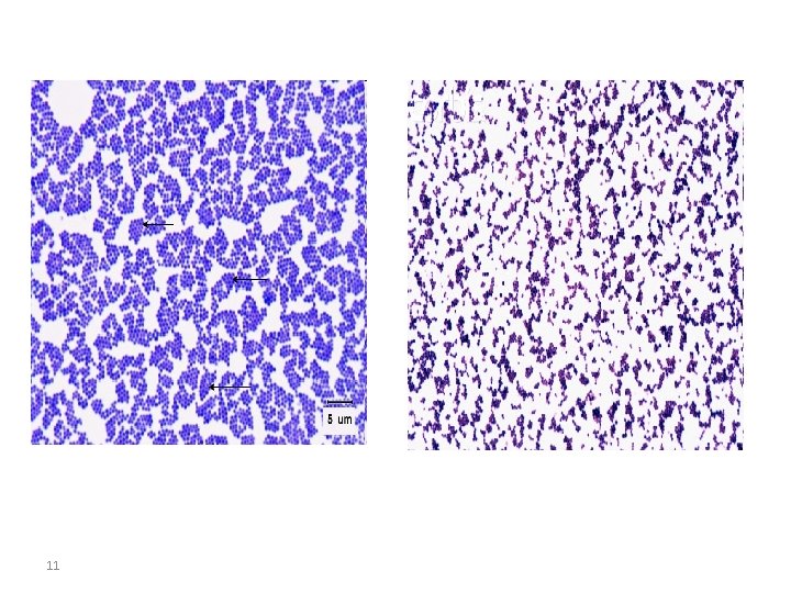 Diagnostic microbiology lecture 8 THE GRAM POSITIVE COCCI