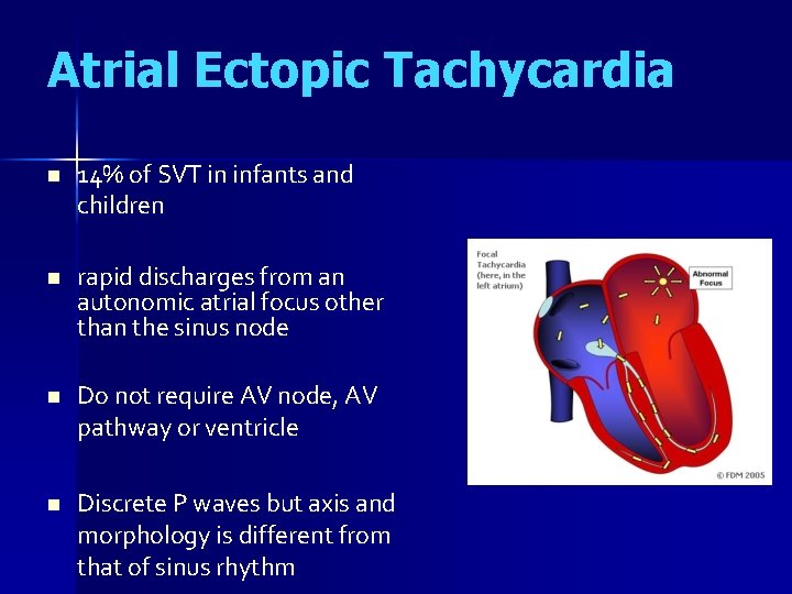 Cardiology Review Part 3 Oct 2018 SVT Case