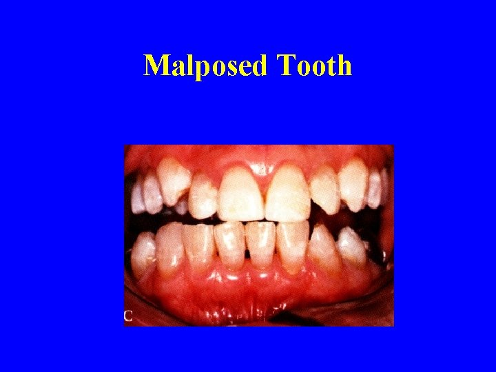 Dental Charting Document clinical findings Baseline for future