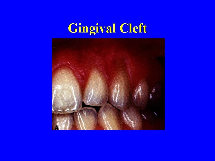 Dental Charting Document clinical findings Baseline for future