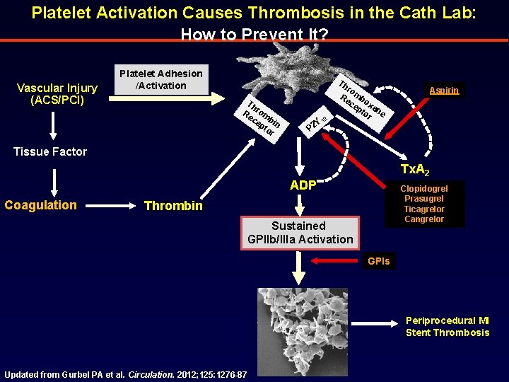 Antiplatelet Options in the Cath Lab How Can