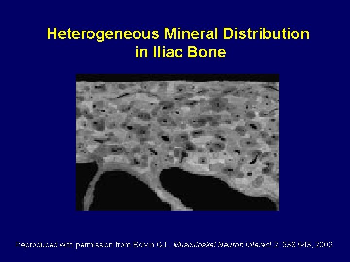 Bone Quality PART 2 Damage Accumulation Degree of