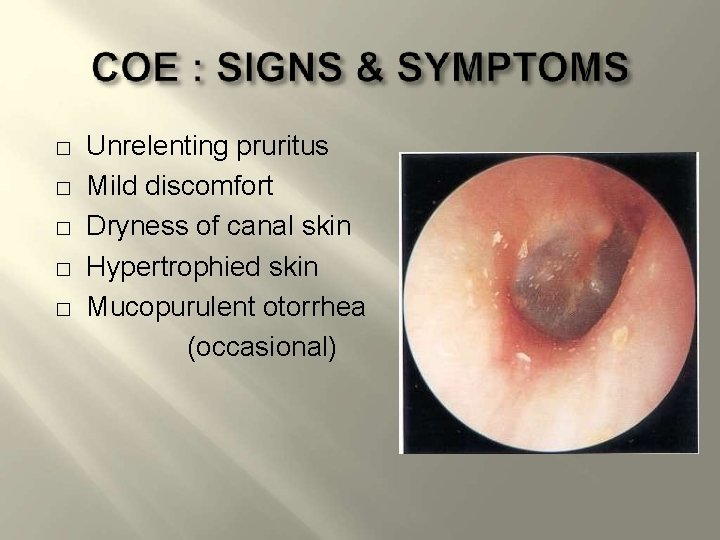 Congenital Abnormalities of Auricle Anotia Microtia Synotia Melotia