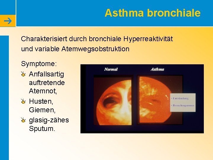 Inhalation von Medikamenten bei Asthma und COPD Deutsche