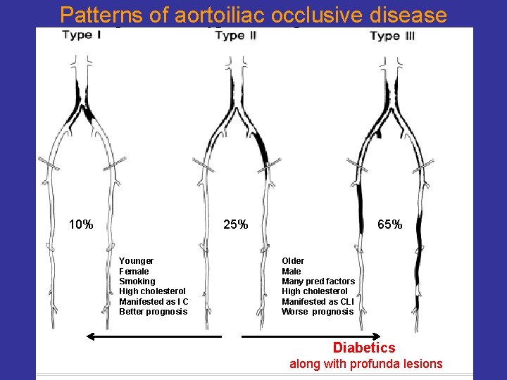 Diabetic Foot and Aortic Disease How should we