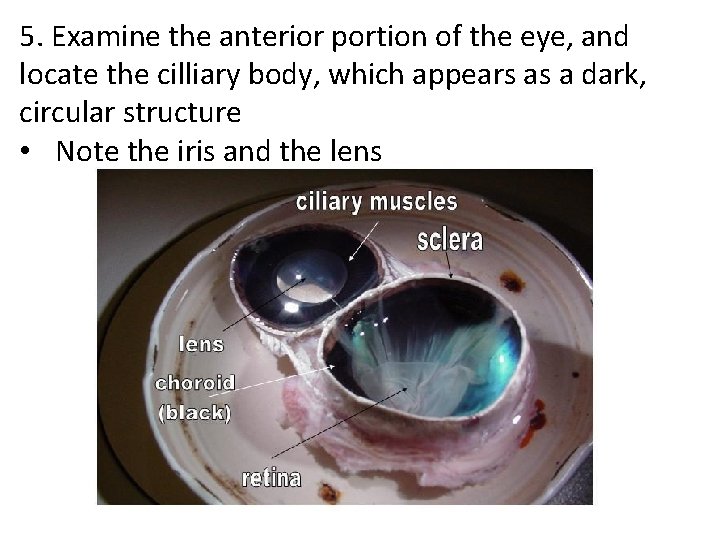 Lab 34 Eye Structure Sheep Eye Dissection Lab