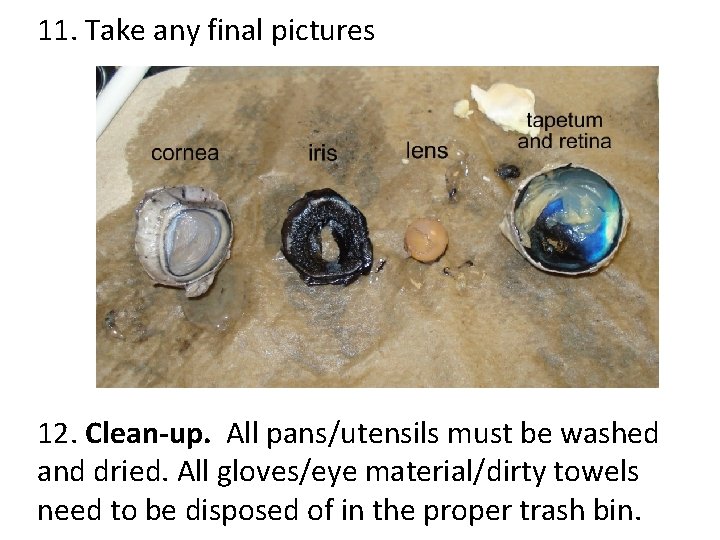 Lab 34 Eye Structure Sheep Eye Dissection Lab