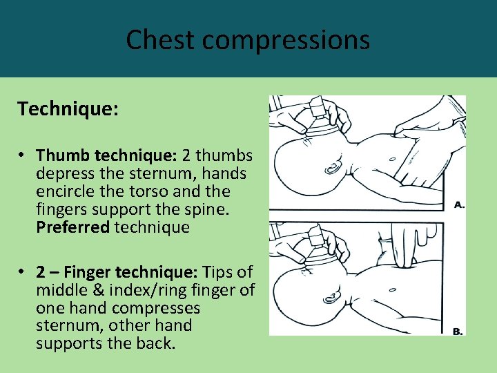 NRP Neonatal Resuscitation program Bill keenan Father of