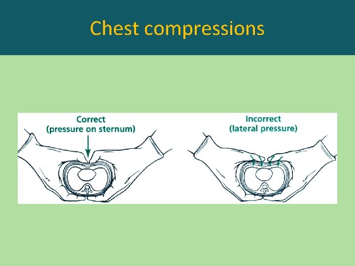 NRP Neonatal Resuscitation program Bill keenan Father of