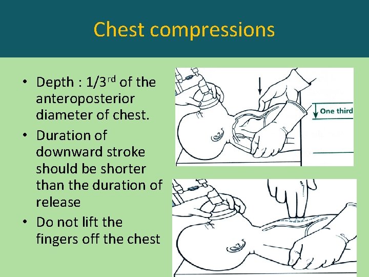 NRP Neonatal Resuscitation program Bill keenan Father of