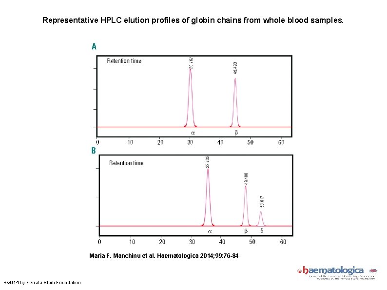 In vivo activation of the human globin gene