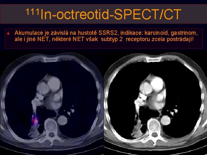 Modern zpsoby zobrazen ndor vpoetn tomografi HYBRIDN ZOBRAZEN