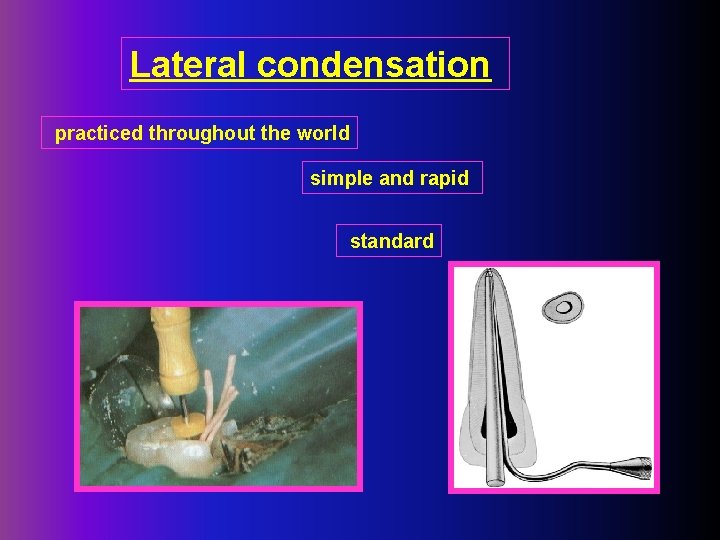 Canal obturation with guttapercha Cold guttapercha techniques Fulllength