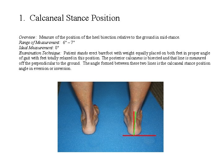 Even Keel Advanced Custom Orthotics Biomechanical Examination Parameters