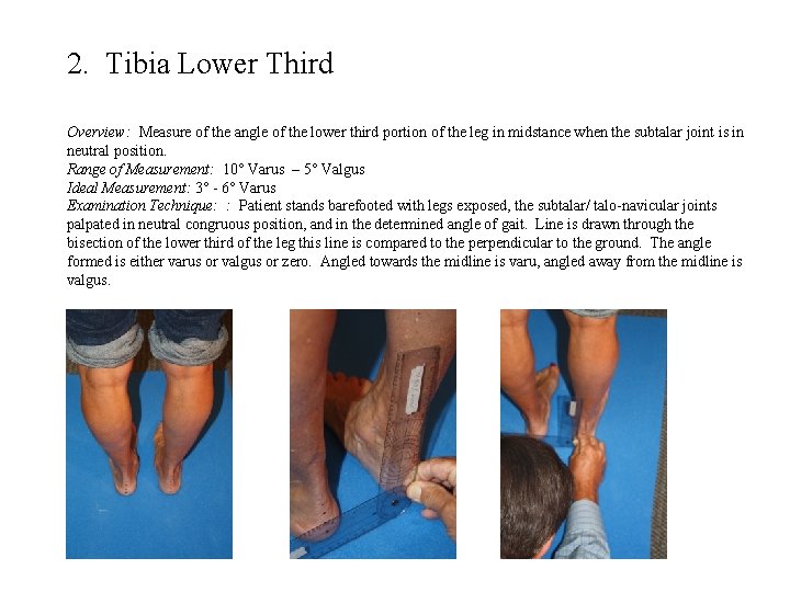 Even Keel Advanced Custom Orthotics Biomechanical Examination Parameters