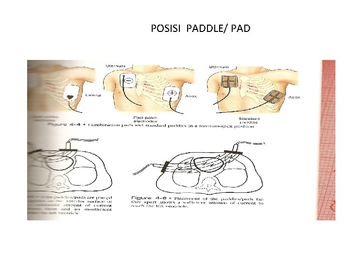 Algoritma Obat Obat Emergency Cardiovascular YULIATI Fakultas Ilmu