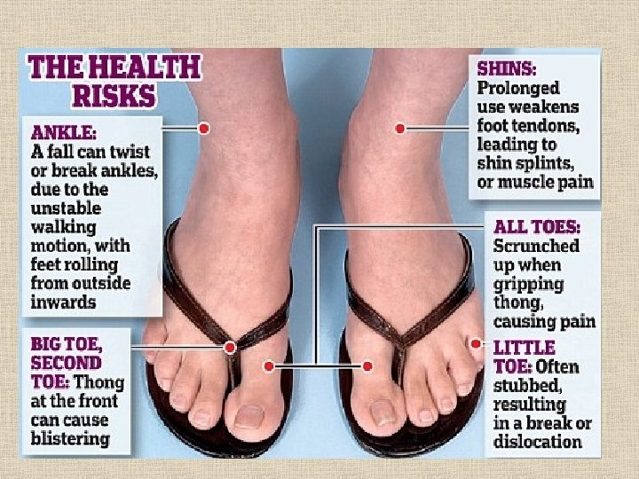 Slipping Tripping Flipping The Most Dangerous Shoe Flipflops