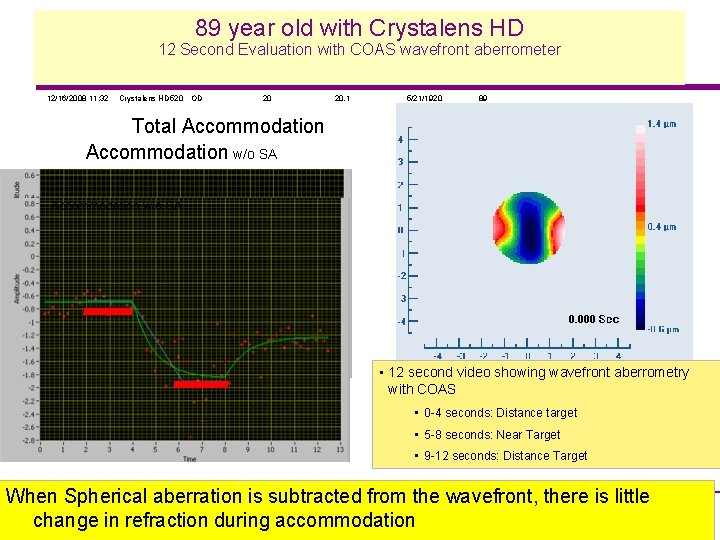 OpenLabel Evaluation of Degree of Accommodation in Pseudophakic