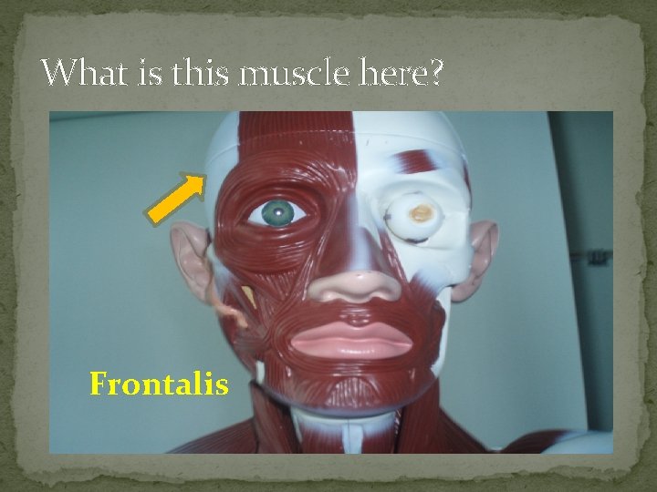 What is this muscle here Frontalis What is