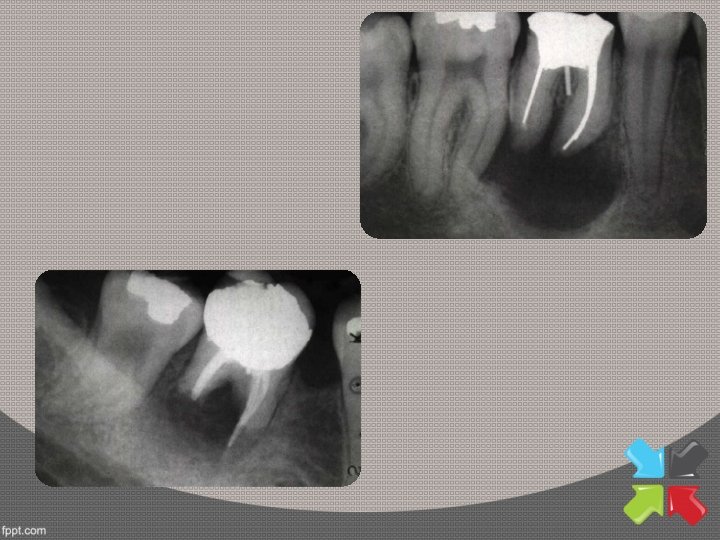 IN THE NAME OF GOD Pulpal and Periapical