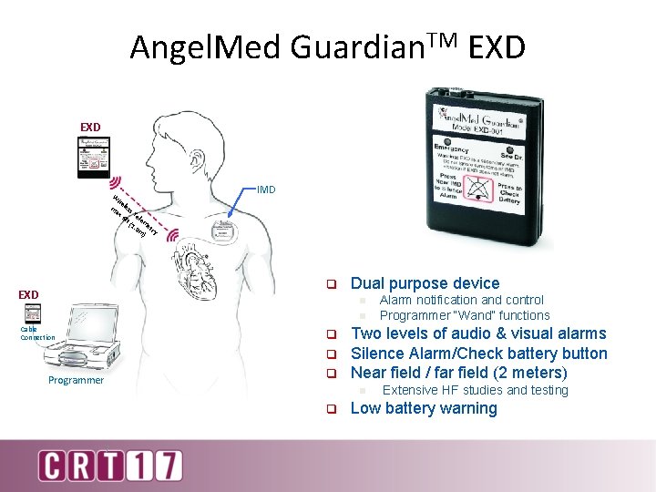 Angel Medical Systems Implantable Ischemia Detection An Update