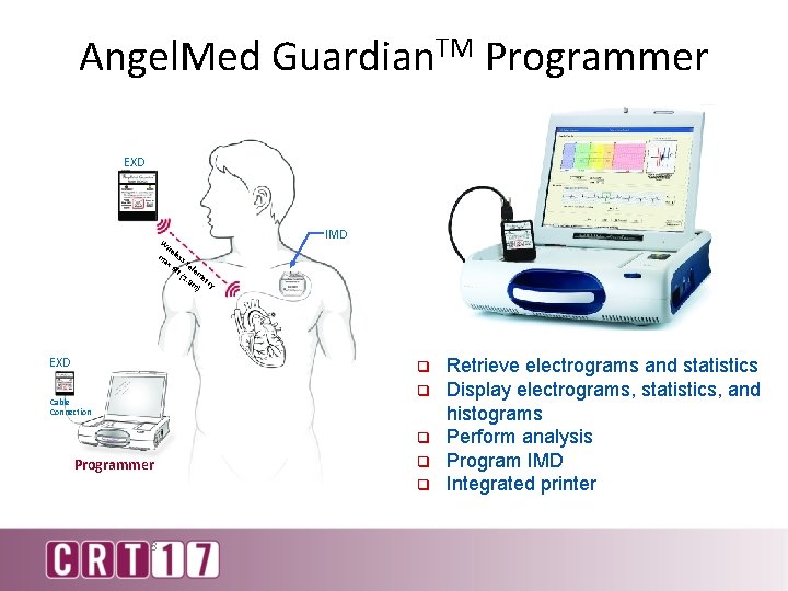 Angel Medical Systems Implantable Ischemia Detection An Update