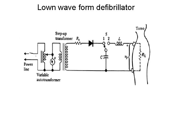 Lecture 4 Defibrillator Arrhythmias SA Block P QRS