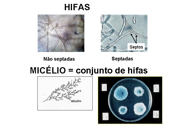 FUNGOS 1 MORFOLOGIA TALO SOMTICO a Leveduriforme unicelular