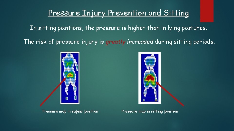 Pressure Injury Prevention and Sitting In sitting positions
