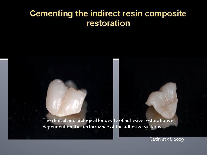 Resin Cements Cementation of Aesthetic Resin Composite Indirect