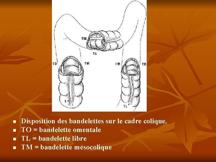 EXPLORATION RADIOLOGIQUE DU COLON DR BOUSSOUF A PLAN